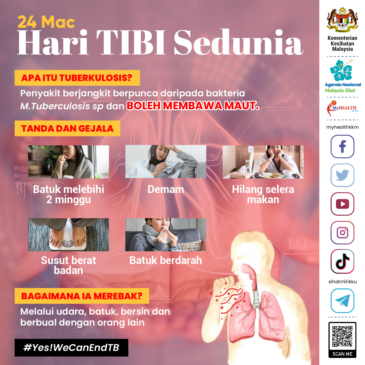 Kematian Akibat Tibi Meningkat Tahun Lepas