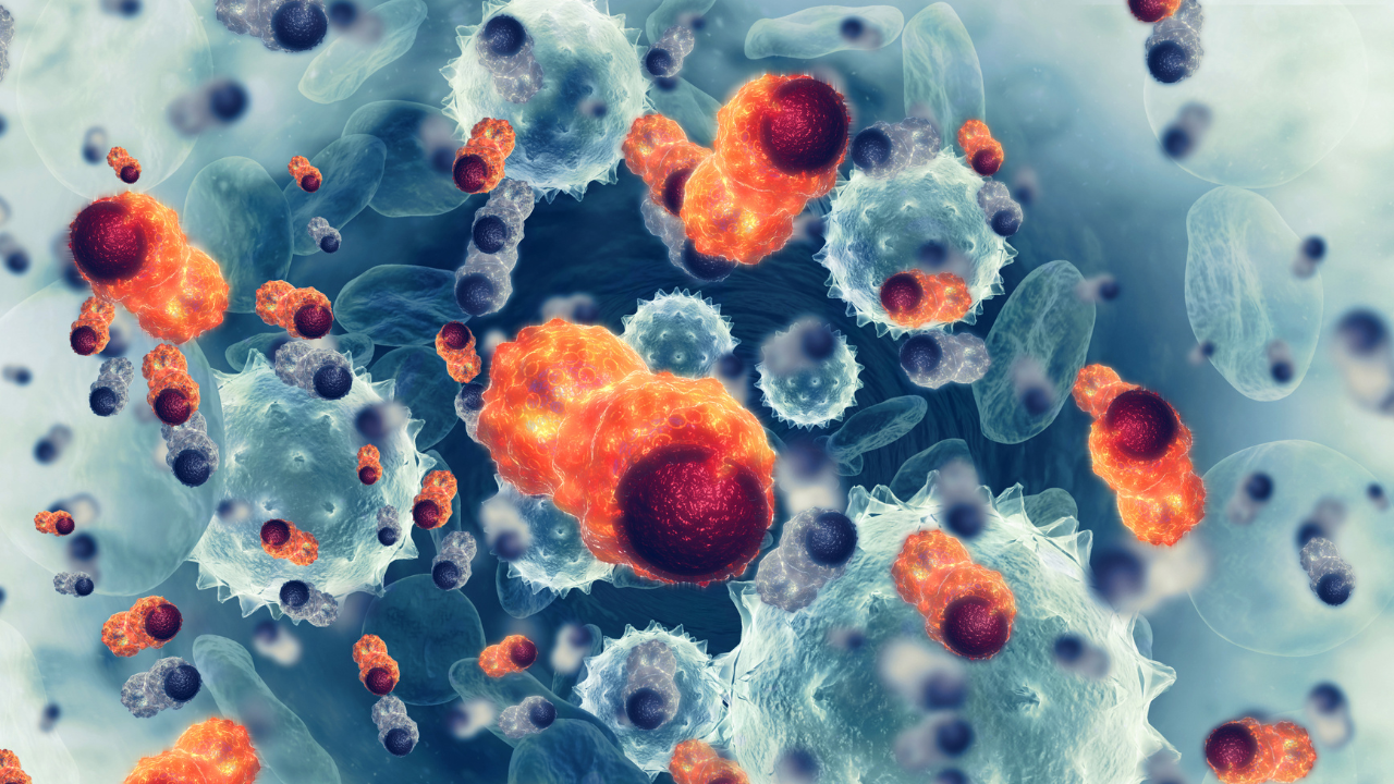 Individu Bawah 50 tahun Paling Ramai Dapat Kanser